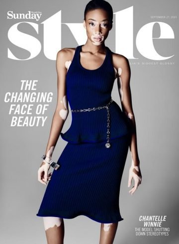 Modelo con vitíligo Winnie Harlow nos da otra lección de belleza ...